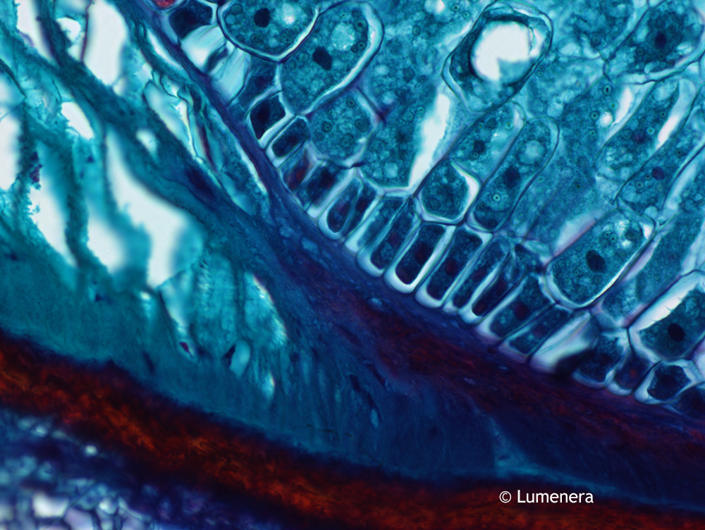 Foot Corn Under Microscope at Carlos Pratt blog