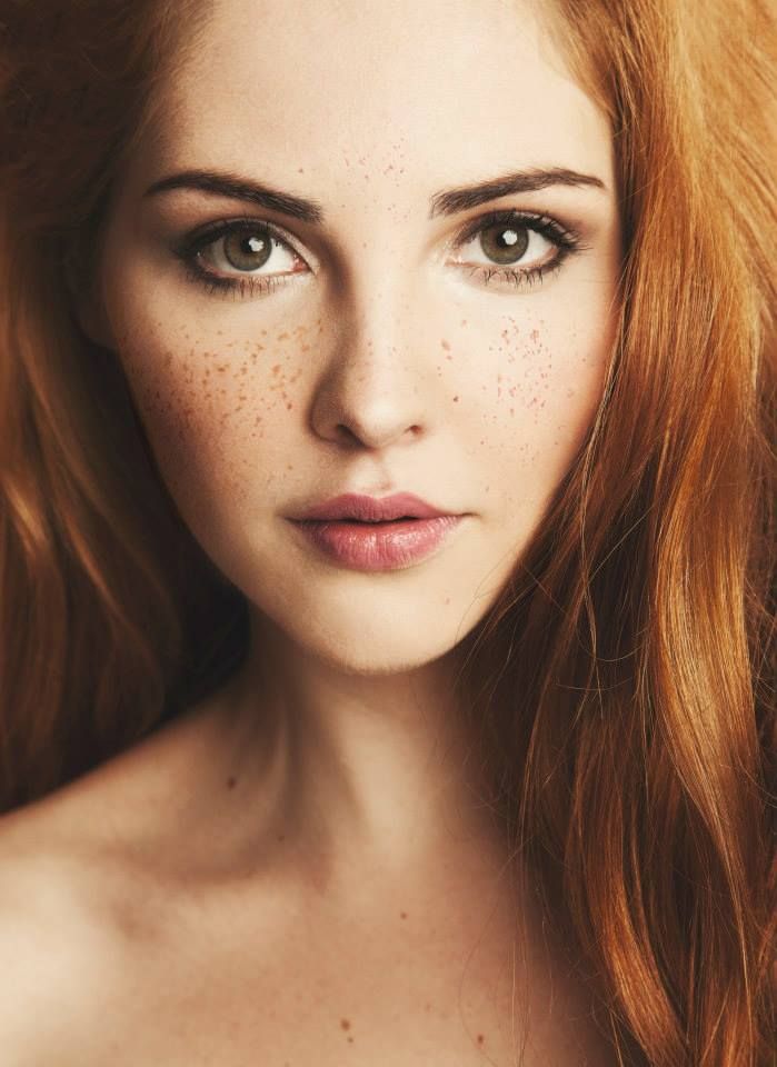 Kaum Ginger, Ras Yang Memiliki Kecantikan Alami Dengan Bintik-bintik ...
