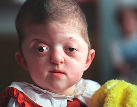 Nuclear and Radiation Disaster