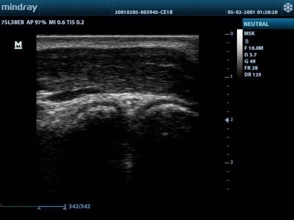 Jual Alat USG 2 Dimensi Portable - Toko Medis Jual Alat Kesehatan