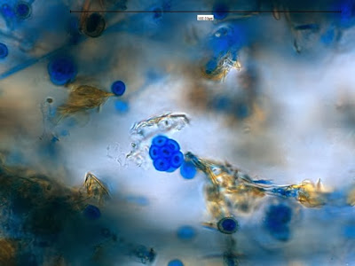 Fun With Microbiology (What's Buggin' You?): 2013