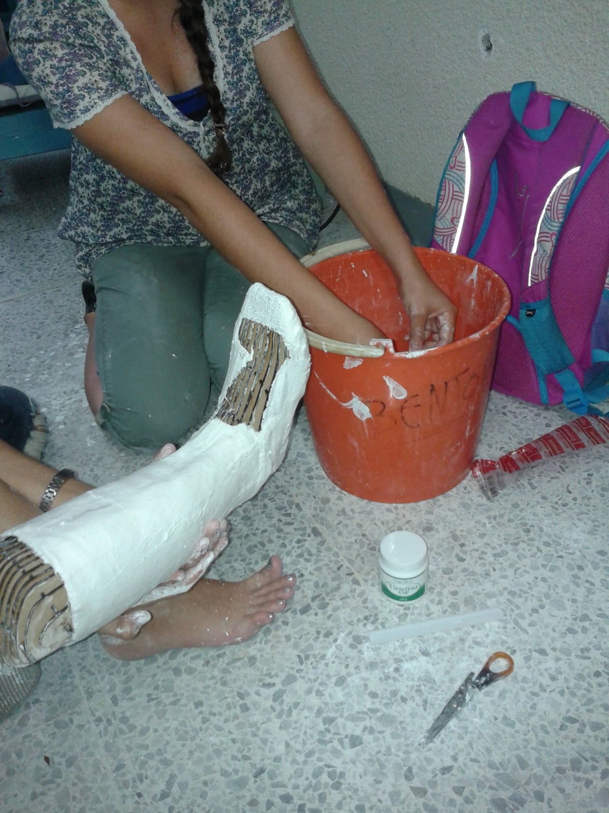 Diseño de Ortesis para pie caído: MOLDE EN YESO