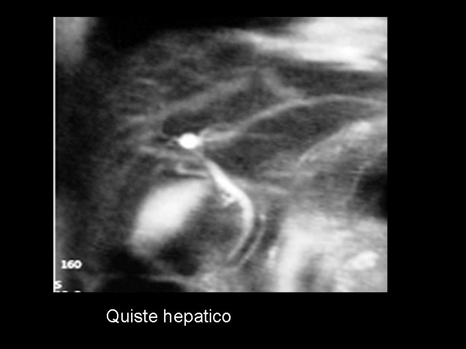 COLANGIO RM: COLANGIO RM