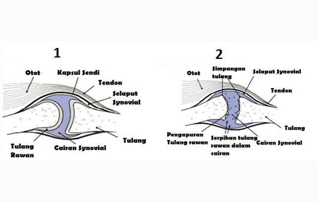 Sendi : Pengertian, Struktur, Fungsi, Komponen - cekrisna
