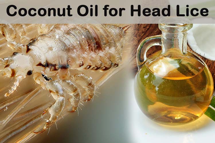 Kindergarten And Mooneyisms Home Remedies To Remove Head Lice