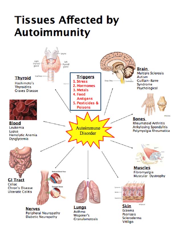Learn and Treatment: Personal Account Autoimmune Neuropathy