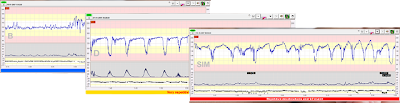 Automated Analysis of Cardiotocograms ~ FannTool