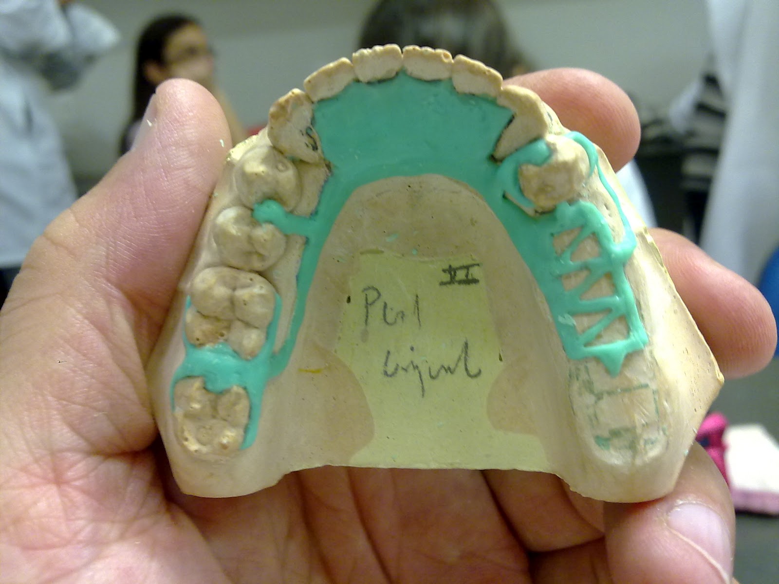 Protese Dentária: PPR - Enceramento de PPR - Fechamento Final - Profº ...