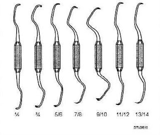 Kuretase Gingiva | Terkadang, ada hal yang hanya dapat diungkapkan ...