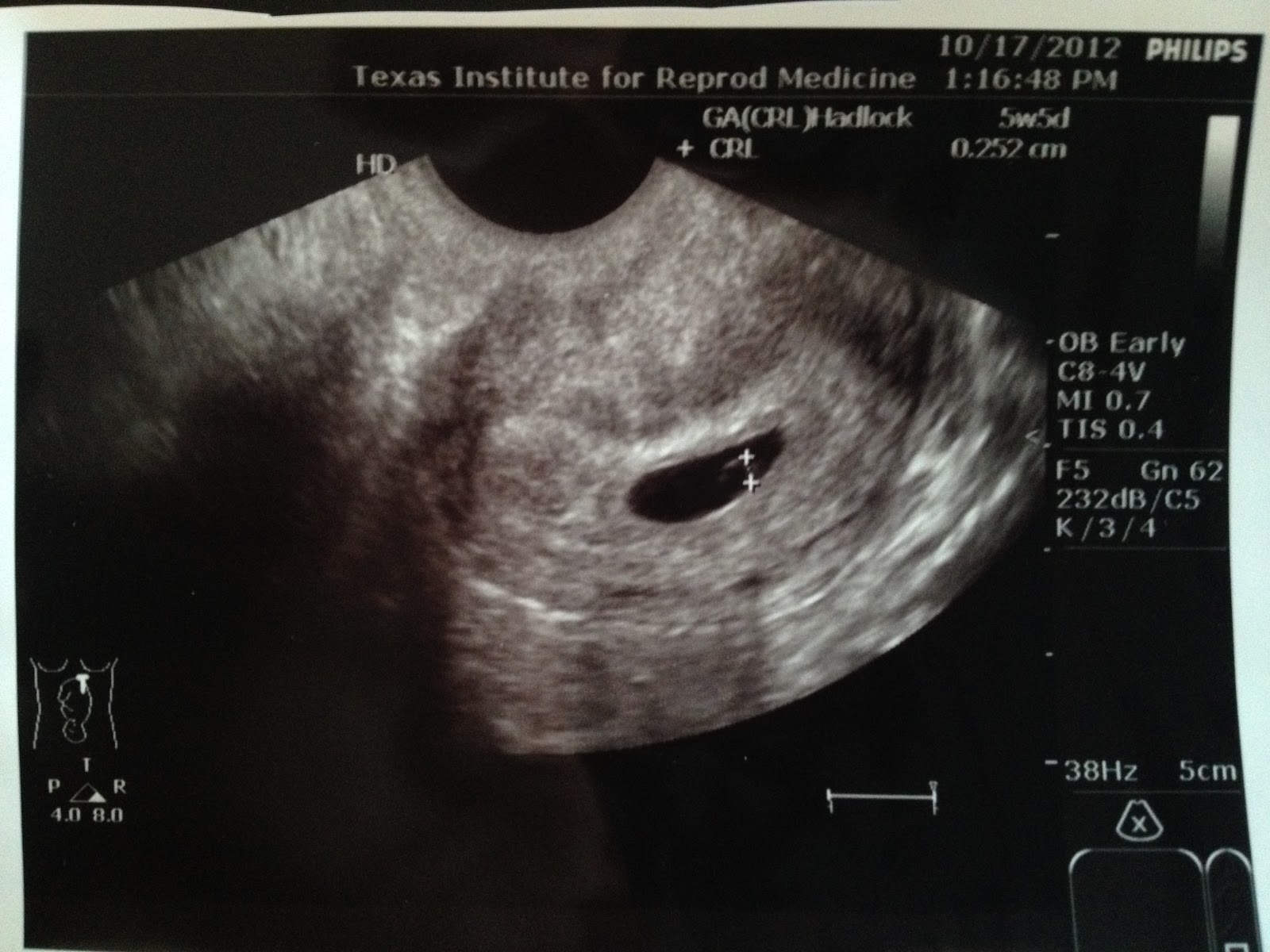 The Stingeries: First Trimester Collection