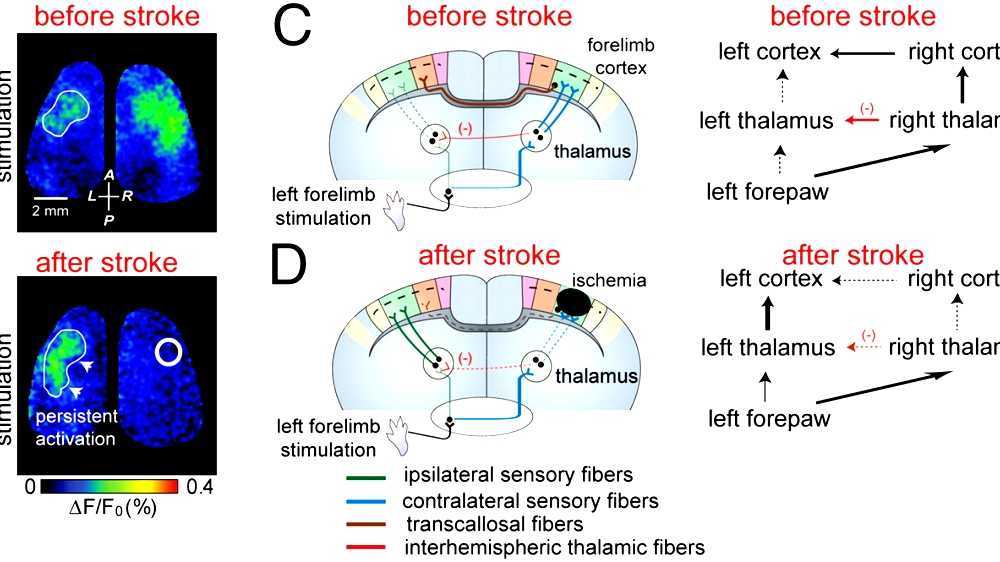 Cortical remapping
