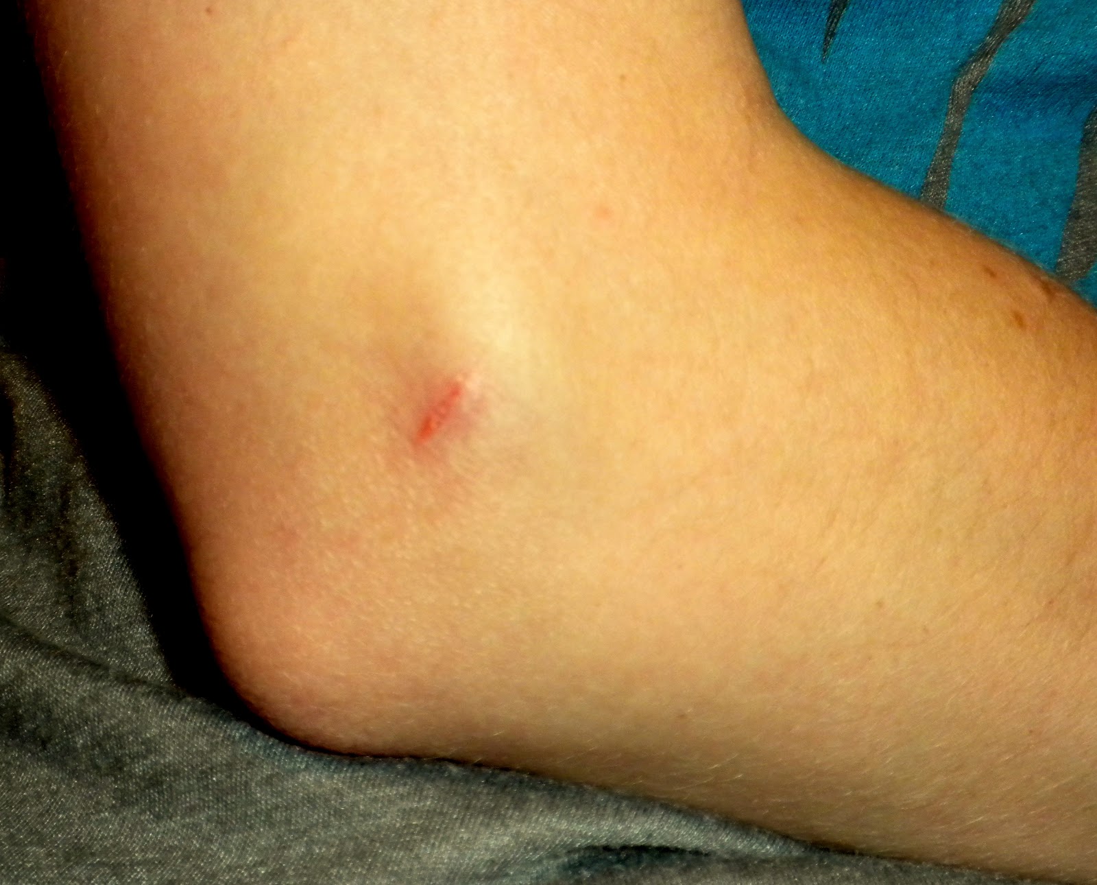 perez family: Bruises & Scrapes, But Still Alive