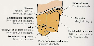 Dentistry and Medicine: PFM (Posterior) Crown Restorations ...