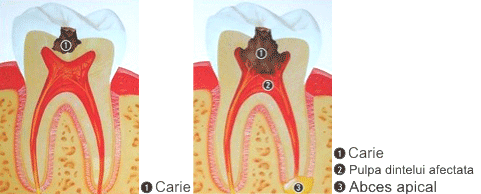 C.M.I Dr. Miclau Lucica Stomatologie Timisoara: Servicii oferite