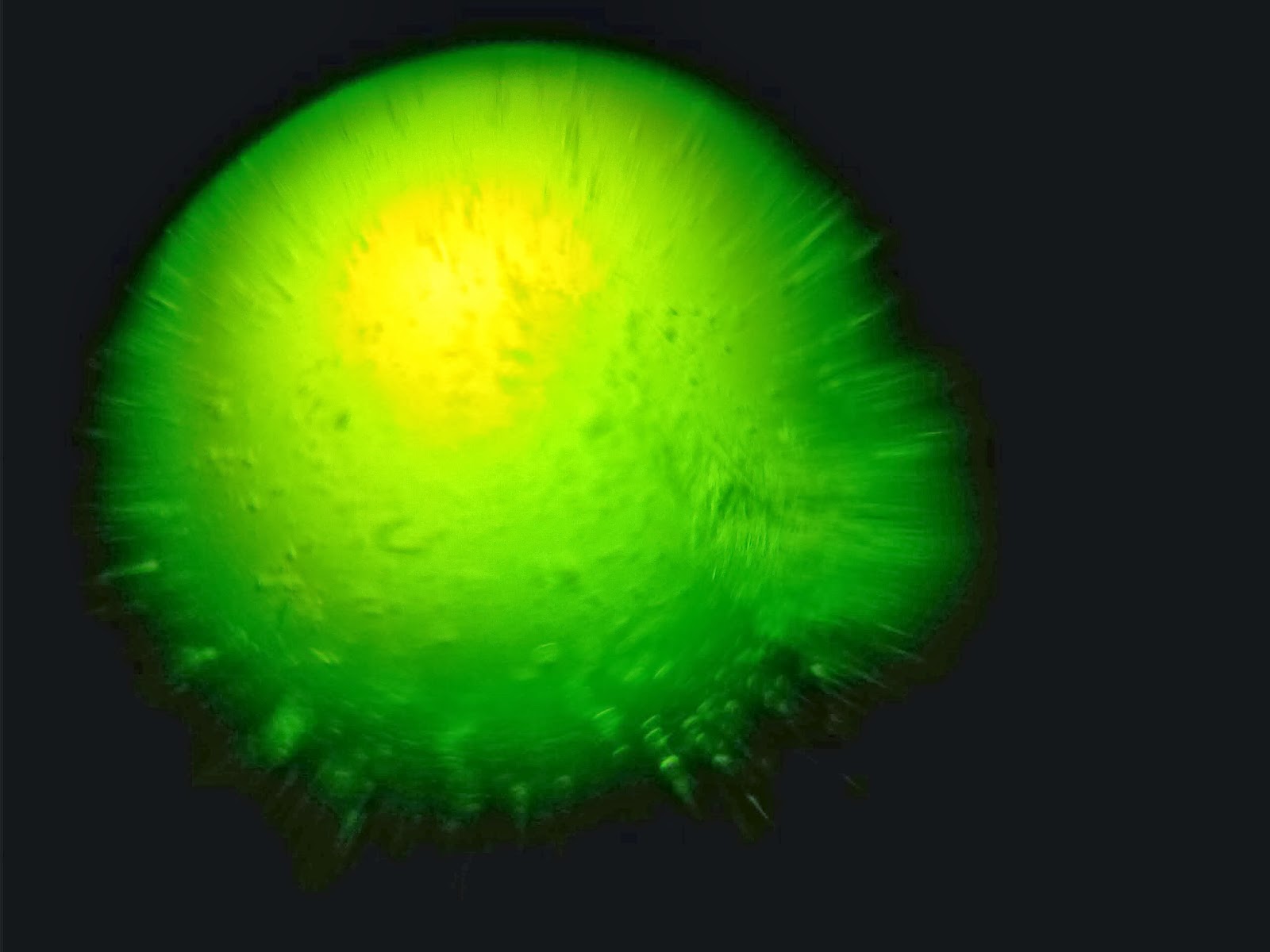 Our TTC Using FertilAid Journey: Fertile-Focus Ovulation Microscope