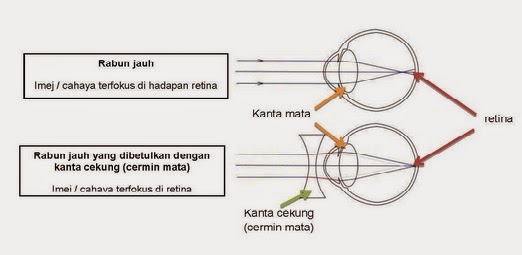 Lagenda Optometrist: RABUN JAUH- PART 2