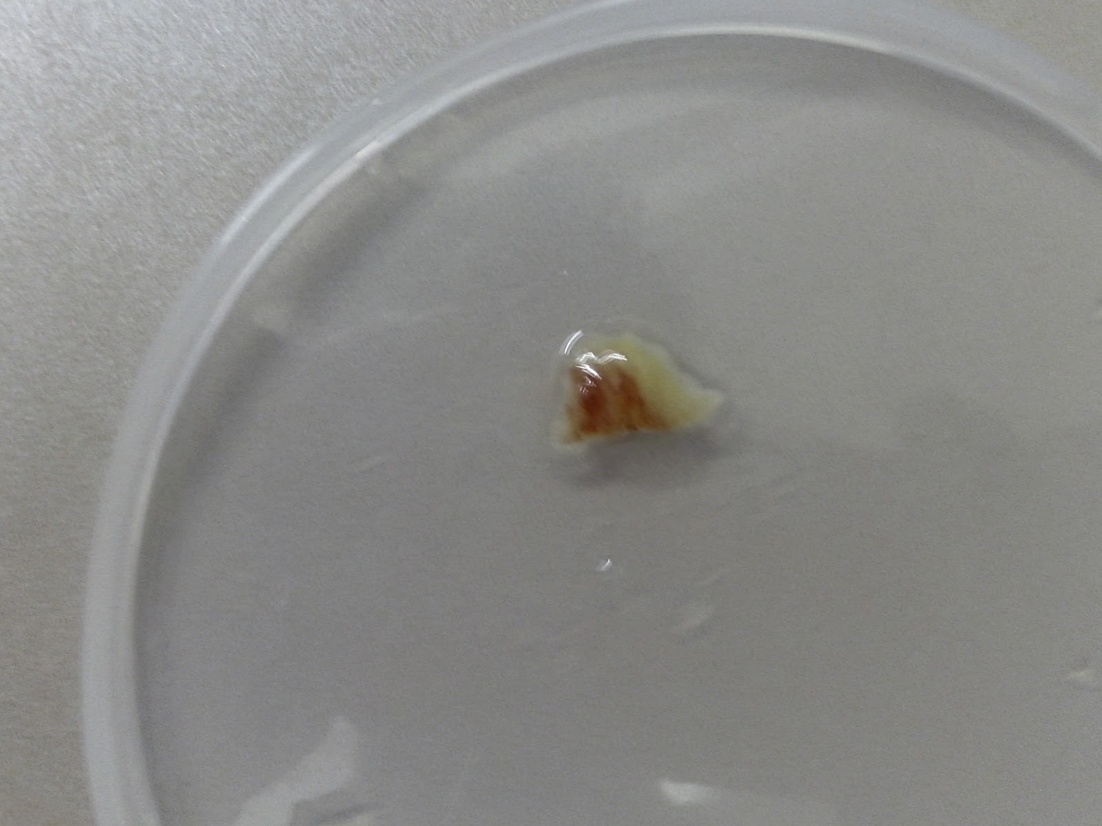 AMIR AIMAN AKASHAH: Dugaan itu ujian hidup