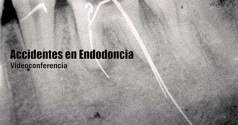 VIDEOCONFERENCIA: Accidentes en Endodoncia - Dr. Arturo Anzardo - Odonto-Tv
