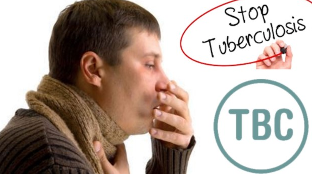 5 CARA PENCEGAHAN TBC - I'm Nurse