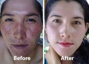 Testimoni Firmax3 Cream - Toko Firmax3 Indonesia