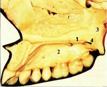 Dentistry lectures for MFDS/MJDF/NBDE/ORE: Note on Radiographic Anatomy ...