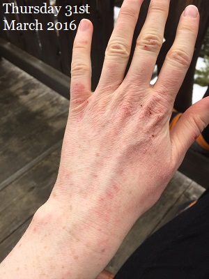 Hand-some | TSW Cara