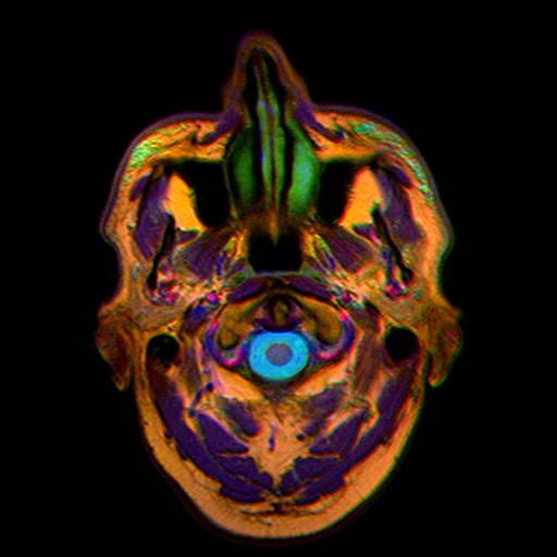 Nevit's blog: Color MRI of the Brain