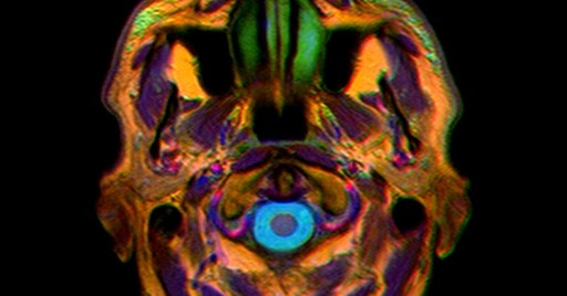 Nevit's blog: Color MRI of the Brain