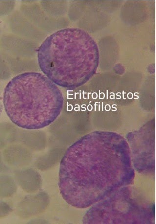 Hematologia: Línea Eritroide Normal