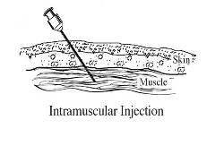 ROUTE OF DRUG ADMINISTRATION ( Part 2/3 ) - Its All About Pharma