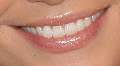 The Top 10 Celebrity Smiles