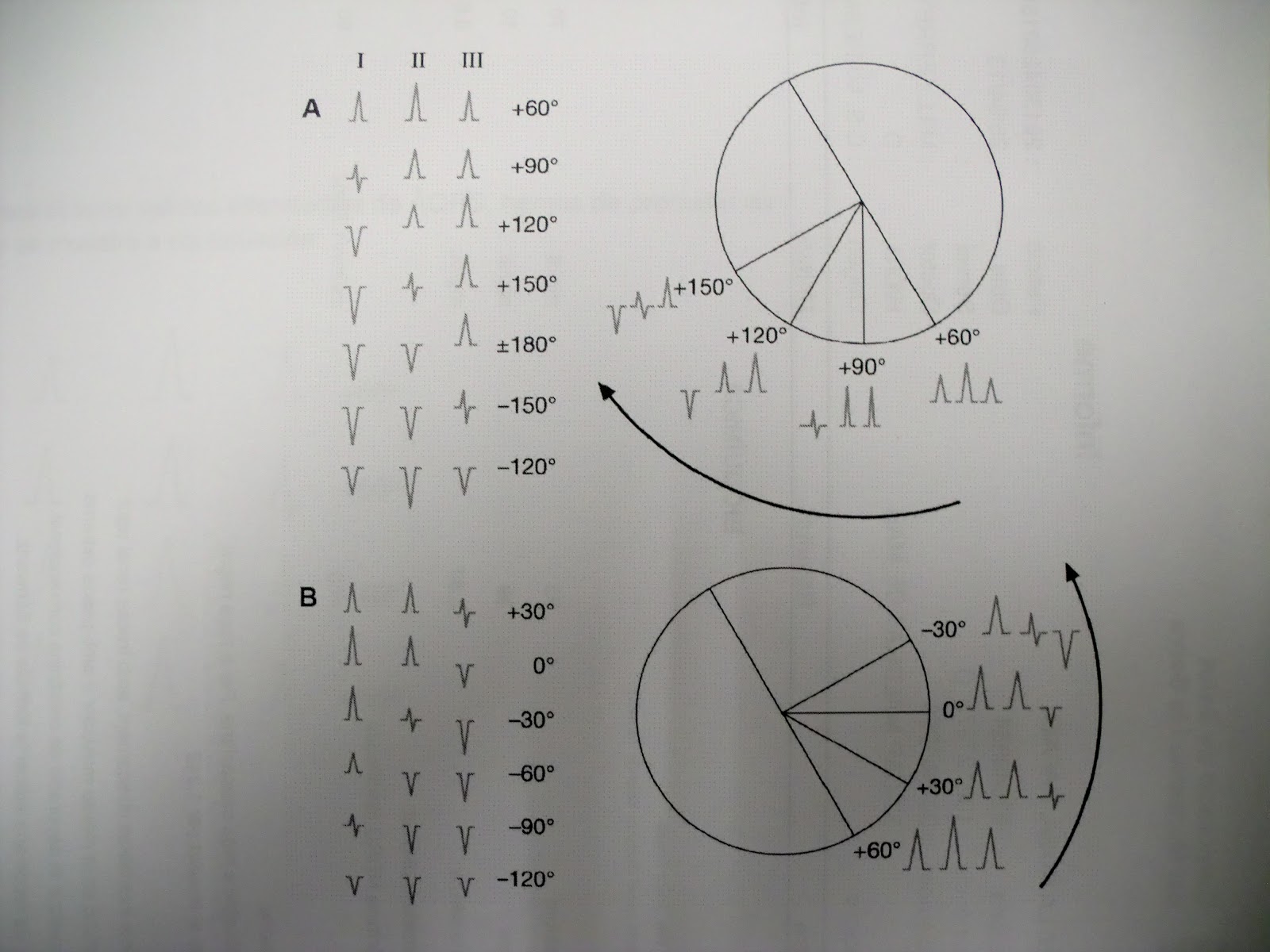 EDUARDO MILL FERREYRA.: Electrocardiografía. Cálculo del eje eléctrico.