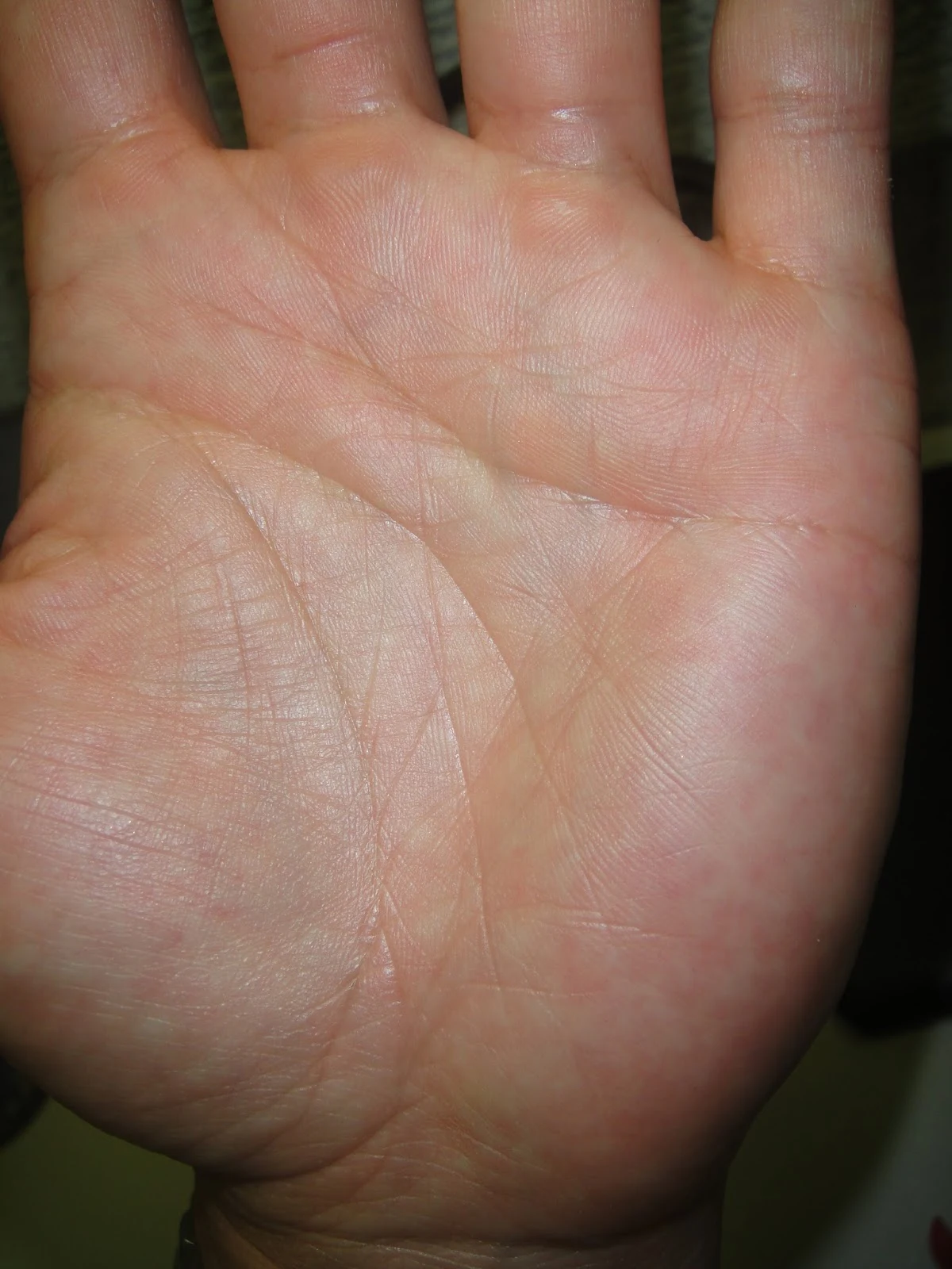 Palmistry Life Line Death & Age | Short & Long Life Line | Double Life ...