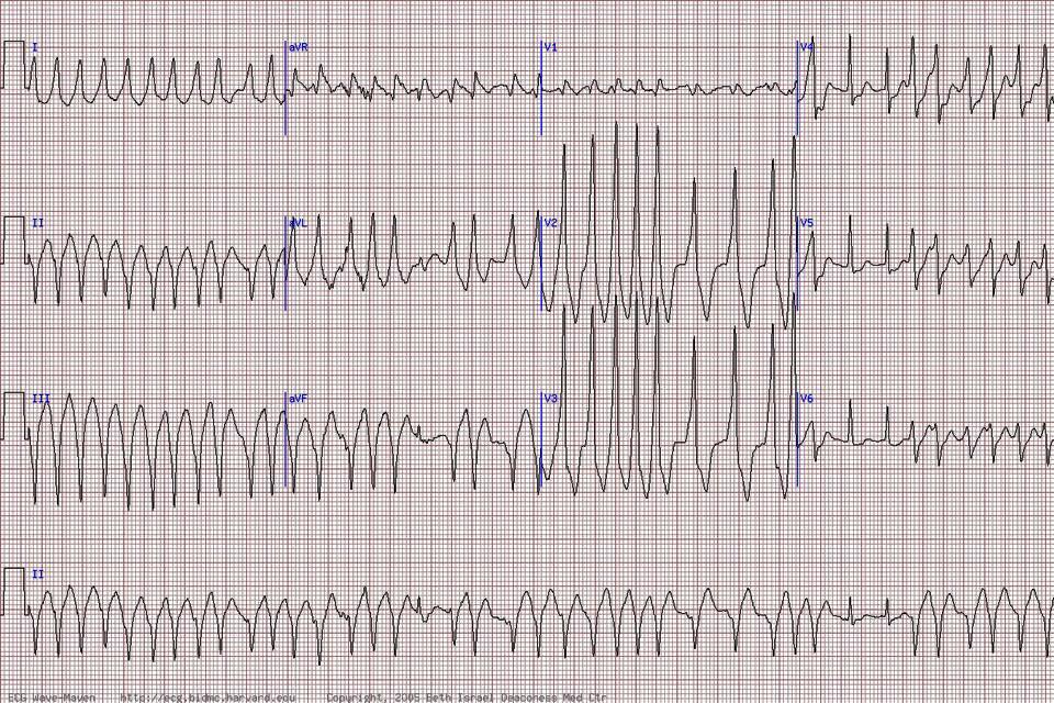 note about case study : สอนดู AF with Wolf