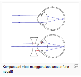 Nursing is a Work of Heart: Prinsip Koreksi Miopi, Hipermetropi, Presbiopi