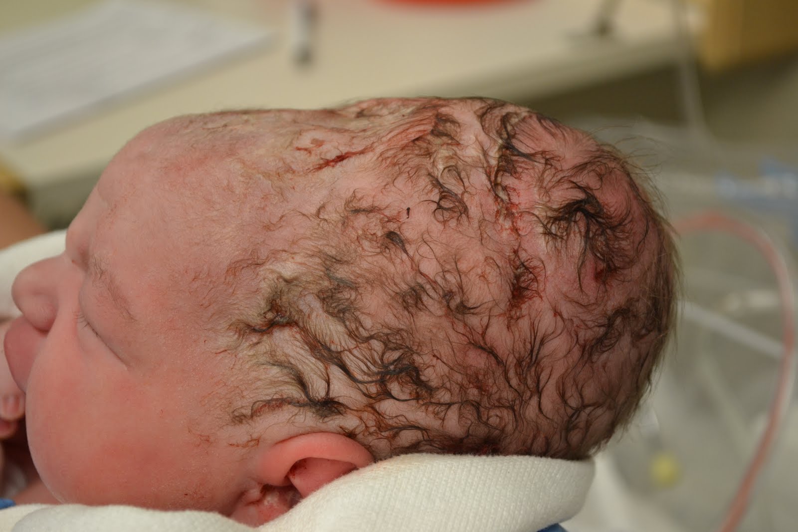 When two become three...: Plan... What birth plan?