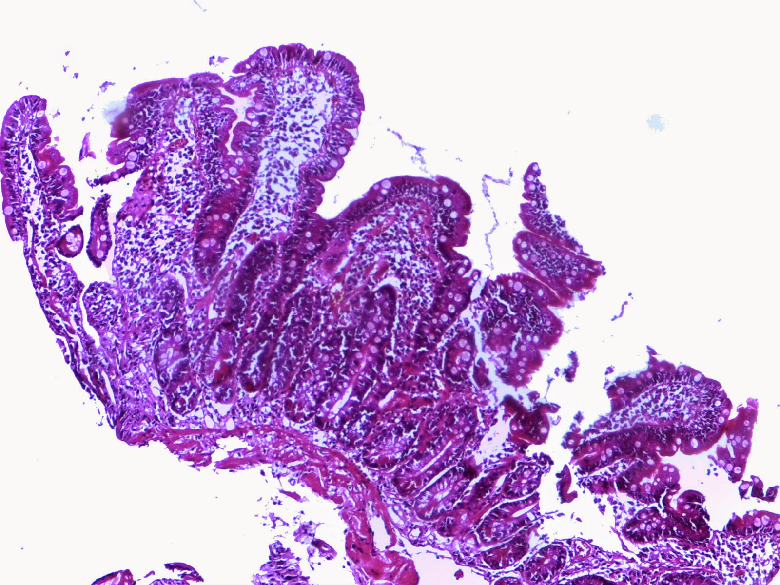 GASTROINTESTINAL AND LIVER HISTOLOGY PATHOLOGY ATLAS: DUODENUM: VILLOUS ...