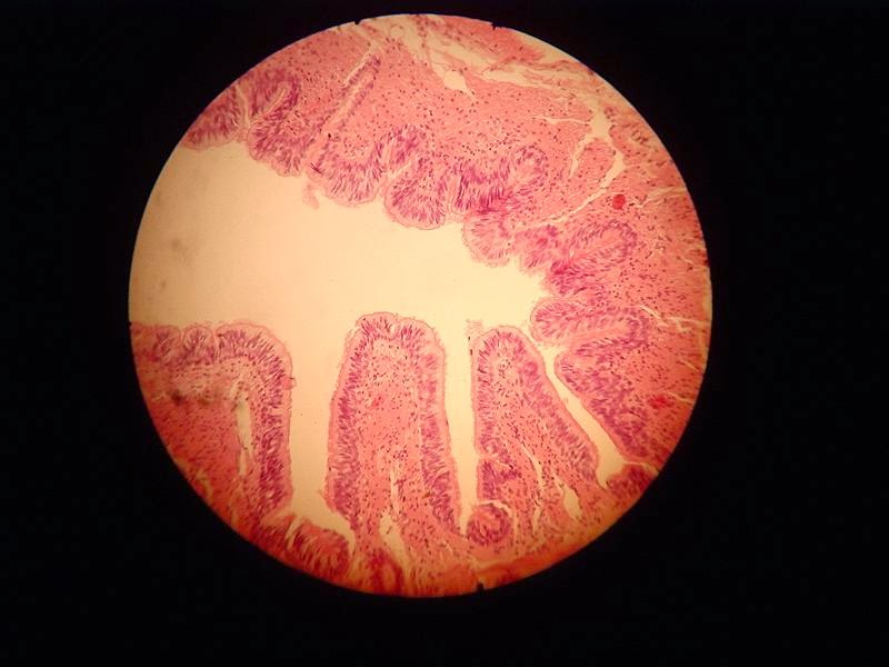 Stud-dent la Facultatea de Medicina Victor Papilian: Histologie - LP