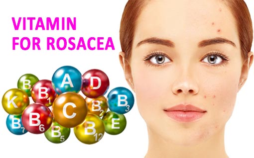 Best Vitamins For Rosacea Nikihow