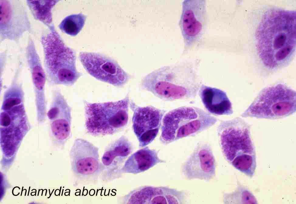 chlamydia diagnosis ~ infectious diseases