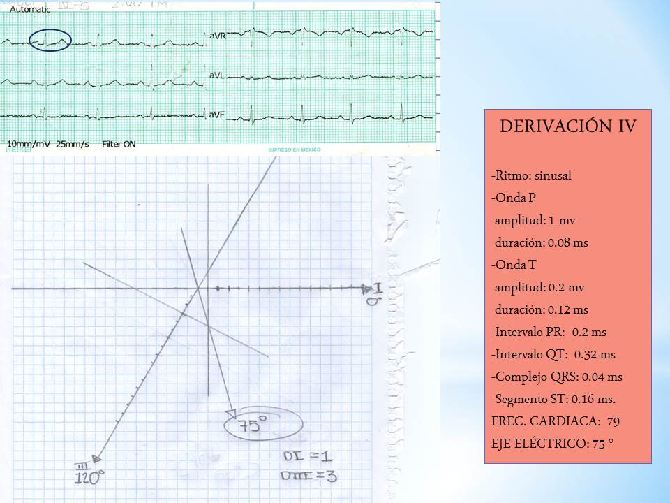PASOS FIRMES: Eje eléctrico y sus variantes de un EKG