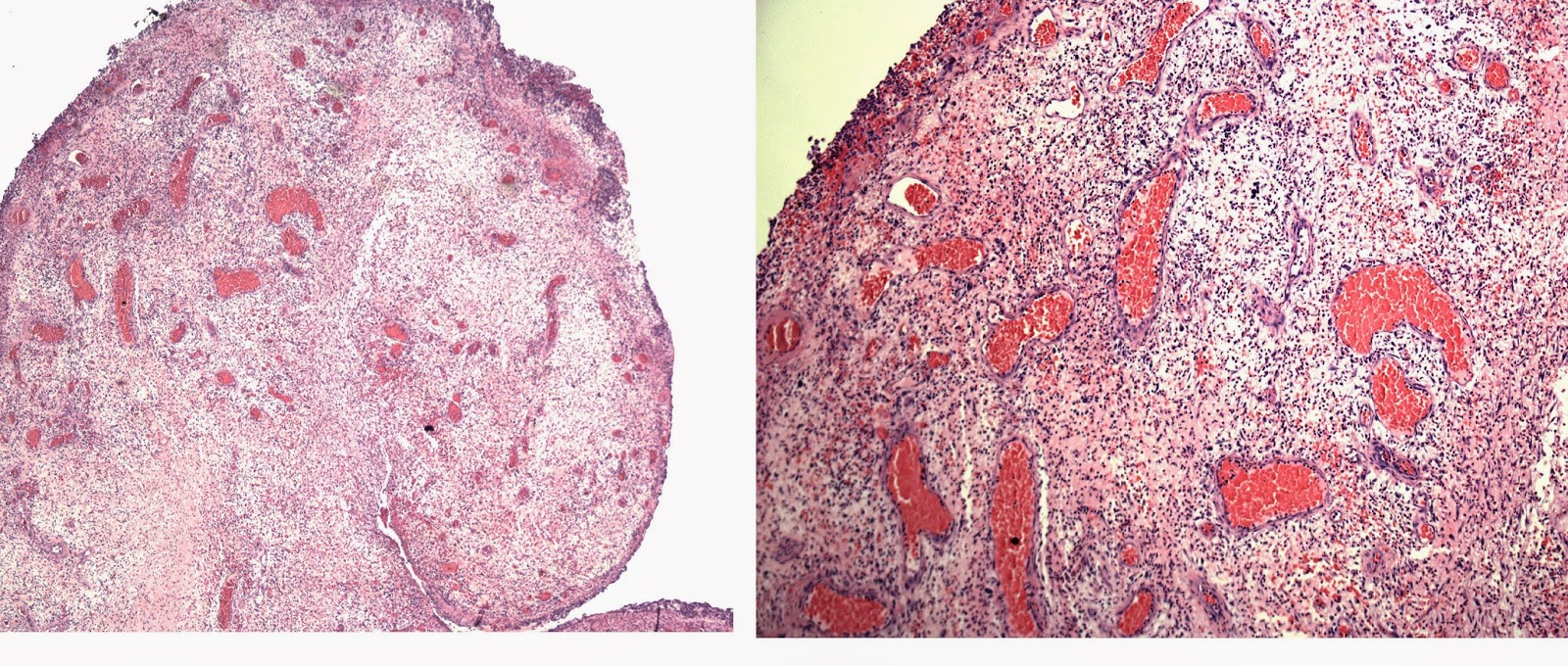 GASTROINTESTINAL AND LIVER HISTOLOGY PATHOLOGY ATLAS: COLON ...