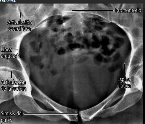 MMII-ARTICULACION COXOFEMORAL-RX FRENTE