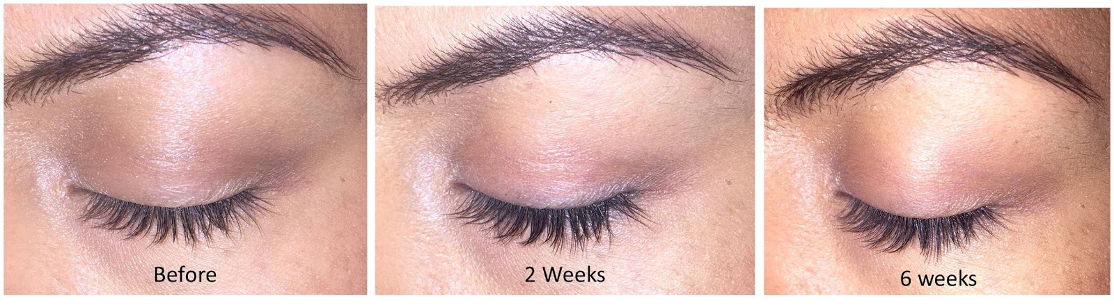 Thicker, Fuller Lashes with Zoria Boost Lash Intensifying Serum ...