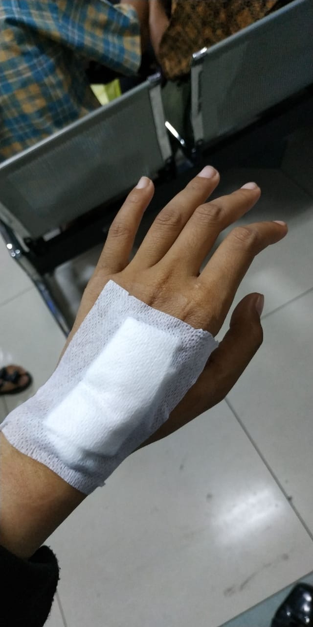 Gambar Tangan Habis Di Infus