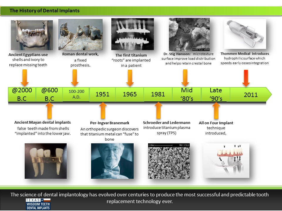 O Higienista Oral: Timeline Implantes