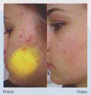 Studio Nails by Luzia