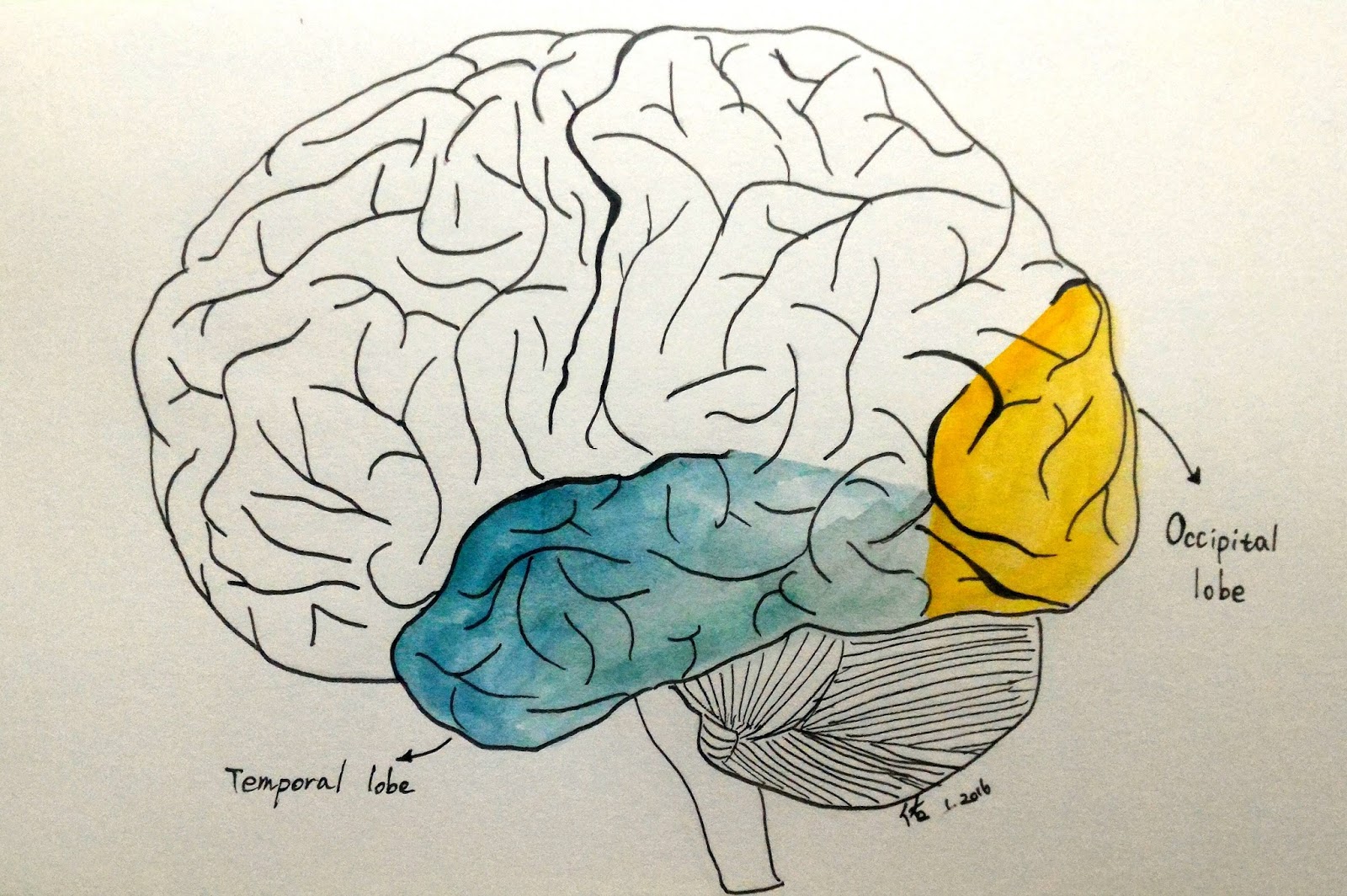 有邊讀邊學生物英文 English for Biology Majors: 【認識疾病】臉盲症（prosopagnosia）