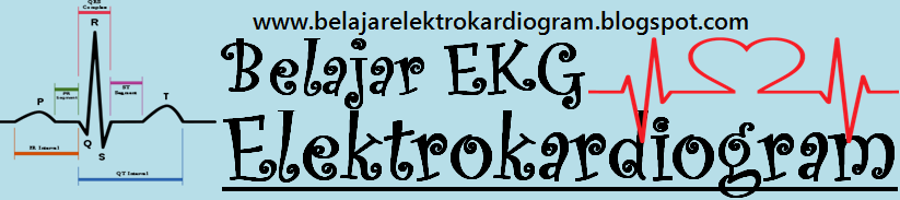Gambaran Tracking EKG yang Normal