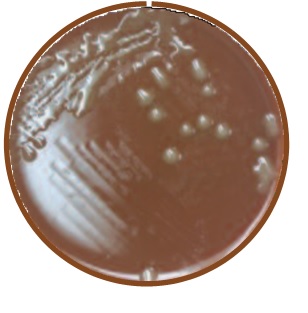 [Microbiology] Chocolate II Agar | Free Medical Atlas
